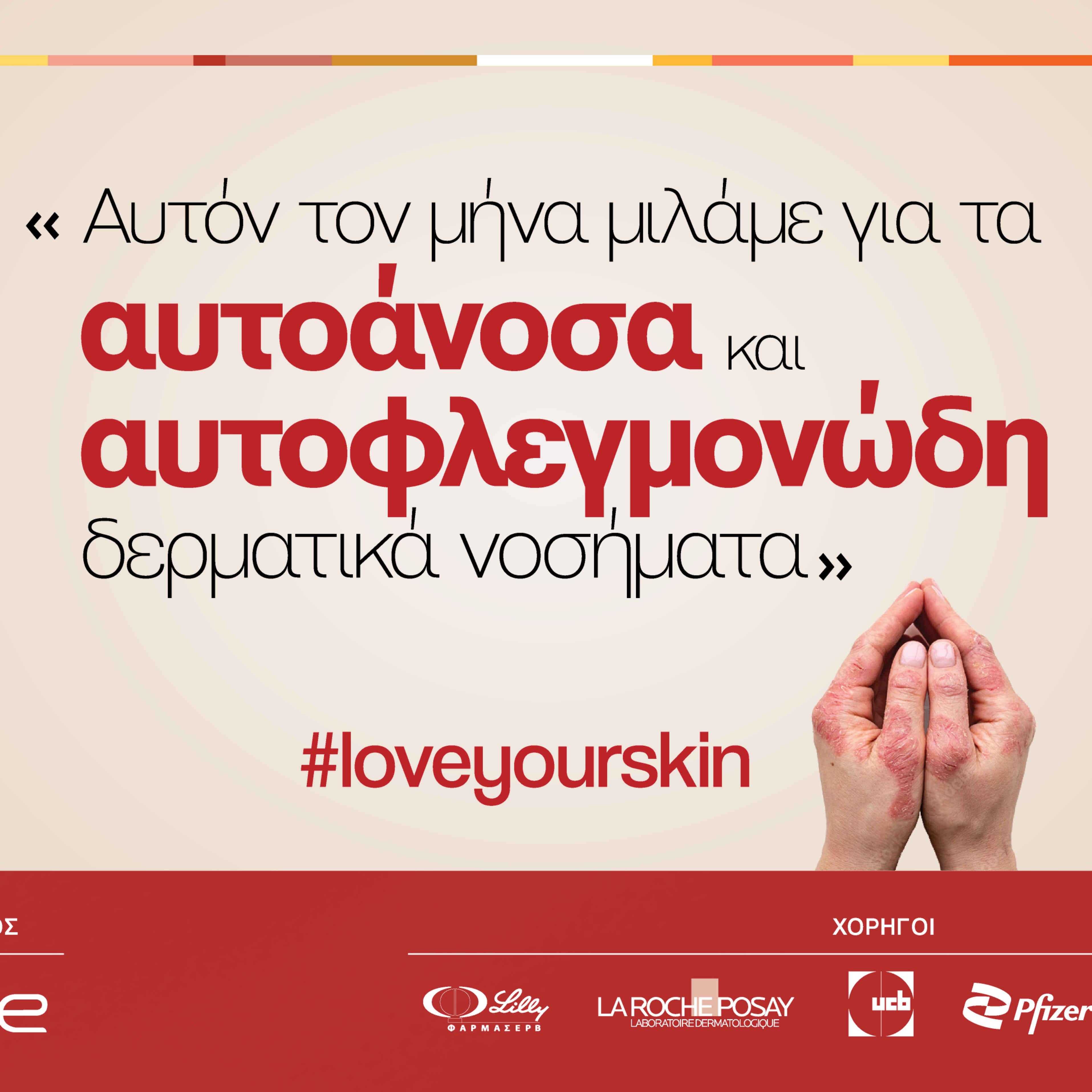 Διαπυητική ιδρωταδενίτιδα – ΕΔΑΕ | Για το Κοινό και Ασθενείς